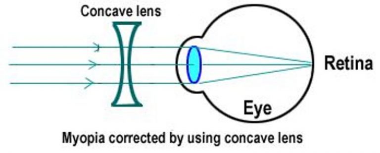 7 Concave Lens Examples in Daily Life – StudiousGuy
