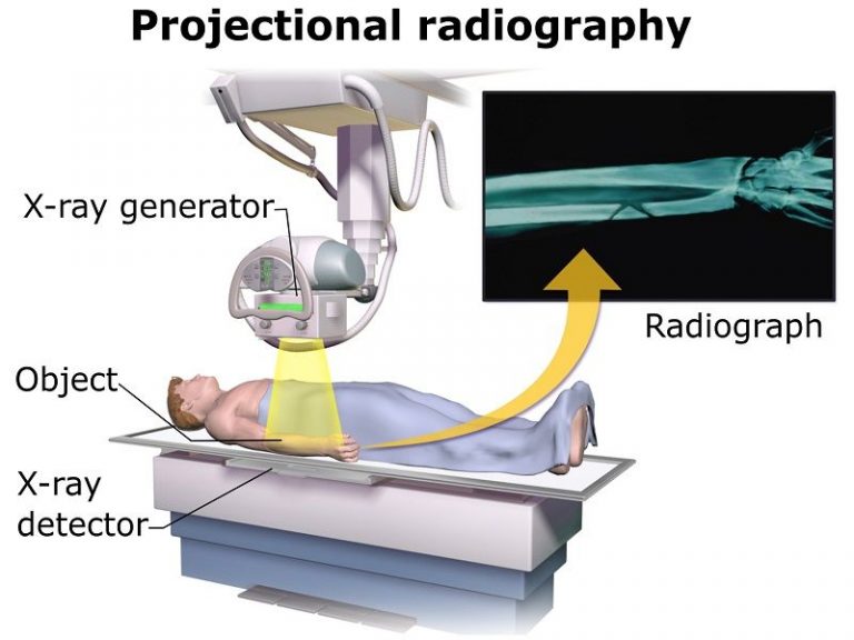 Working Principle of X-Ray Machine – StudiousGuy
